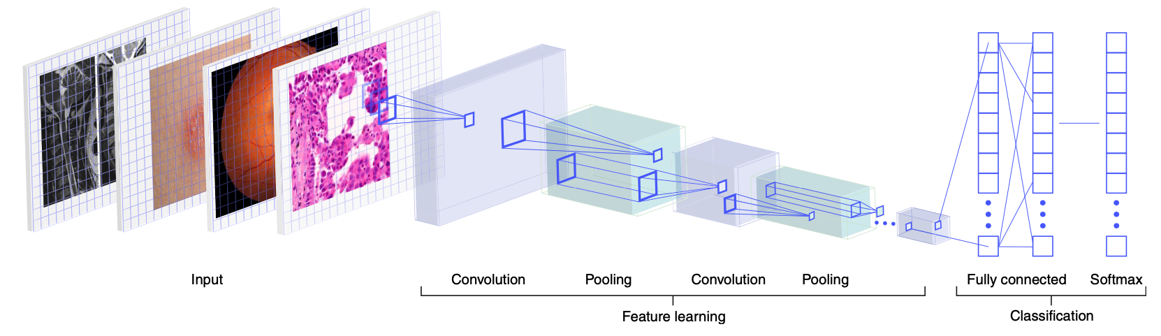 의료분야에서의 인공지능 | 인포리언스